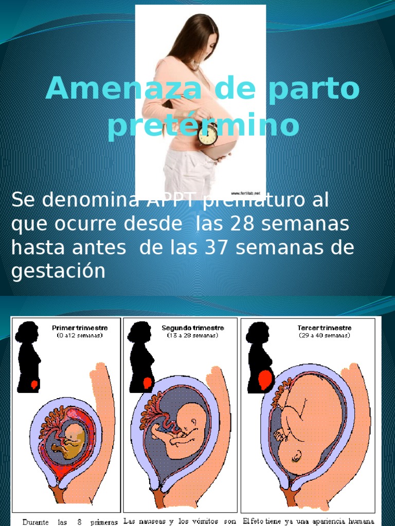 Amenaza de Parto Pretérmino | Parto prematuro | Parto
