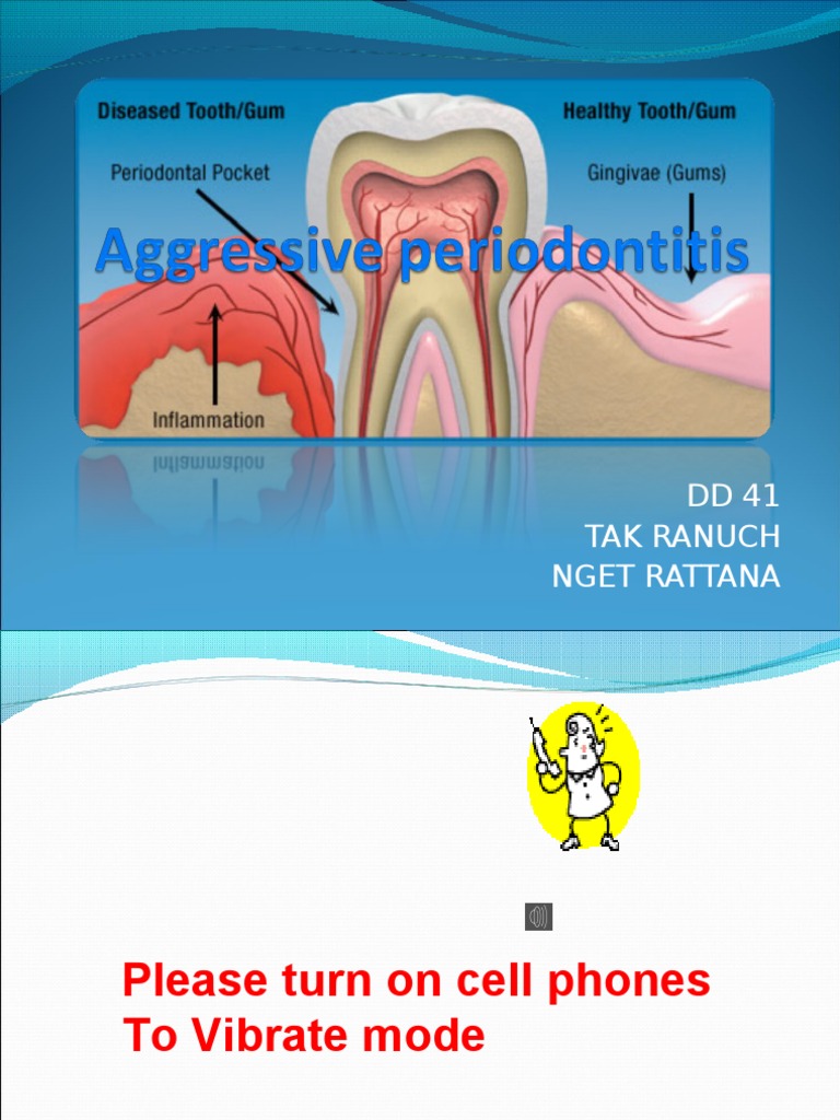 Aggressive Periodontitis | Immunology | Medicine