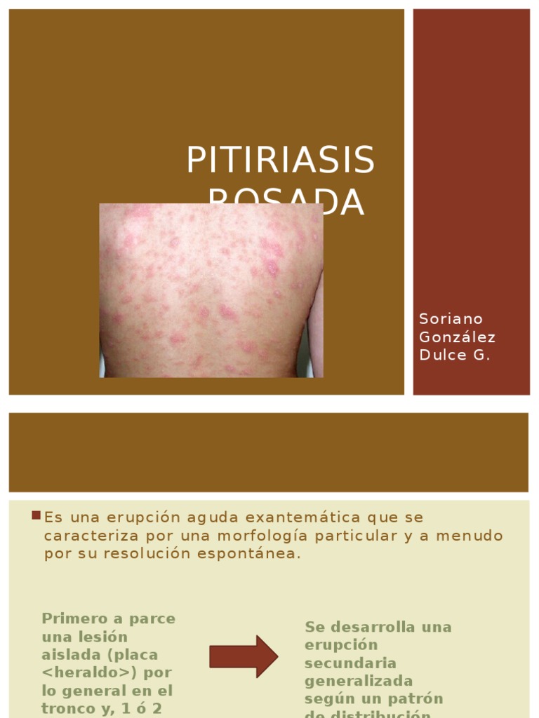 Pitiriasis Rosada | Pie | Piel | Free 30-day Trial | Scribd