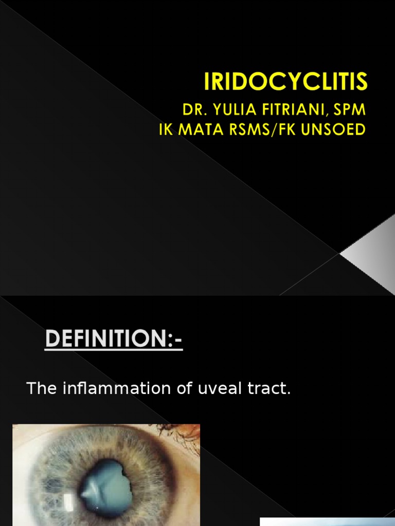 Yl IRIDOCYCLITIS | PDF | Eye | Vision