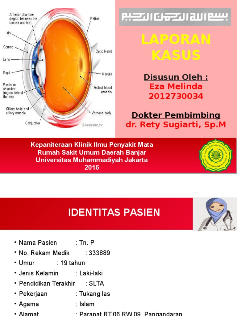 DIAGNOSIS DAN PENATALAKSANAAN KASUS CORPUS ALIENUM PADA MATA | PDF