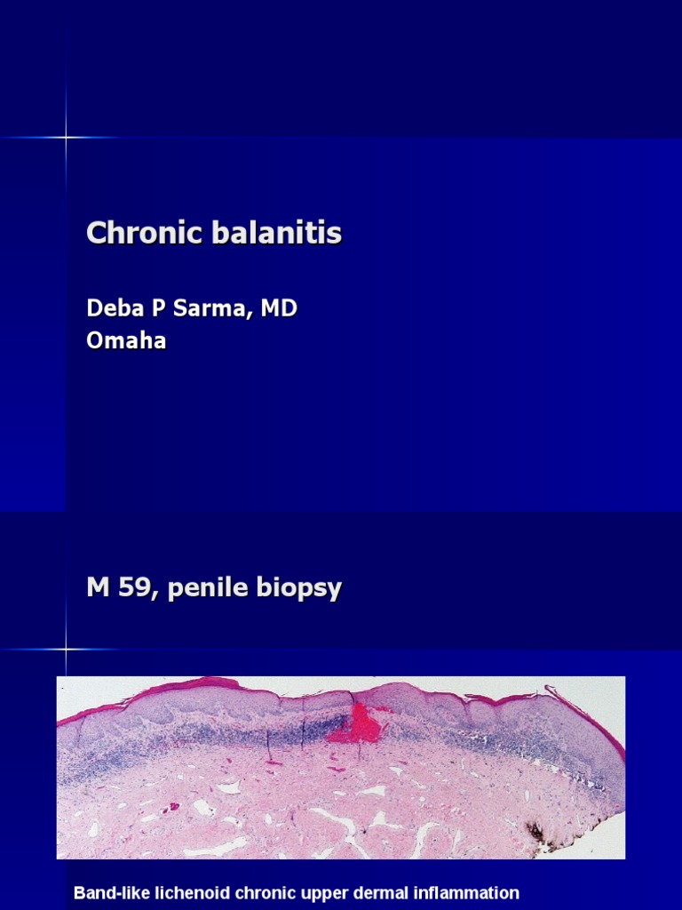 Chronic Balanitis | PDF | Cutaneous Conditions | Immune System Disorders