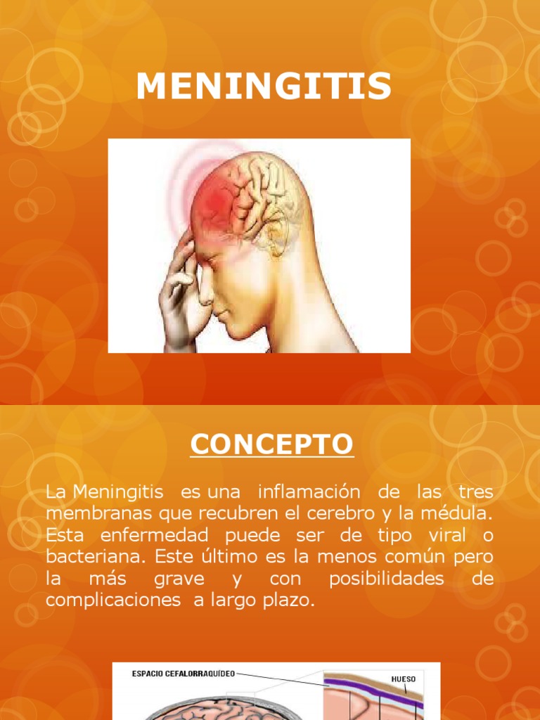 Meningitis Final | PDF | Meningitis | Virus