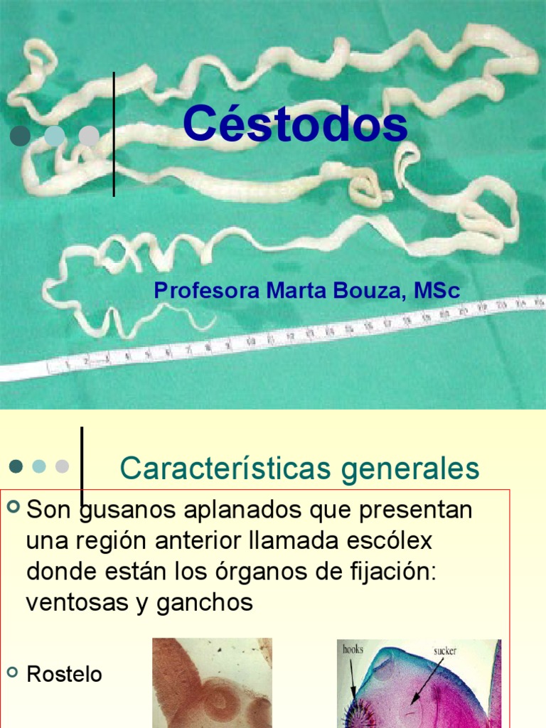 15754286-Cestodos.ppt | Salud pública | Ciencias de la Salud