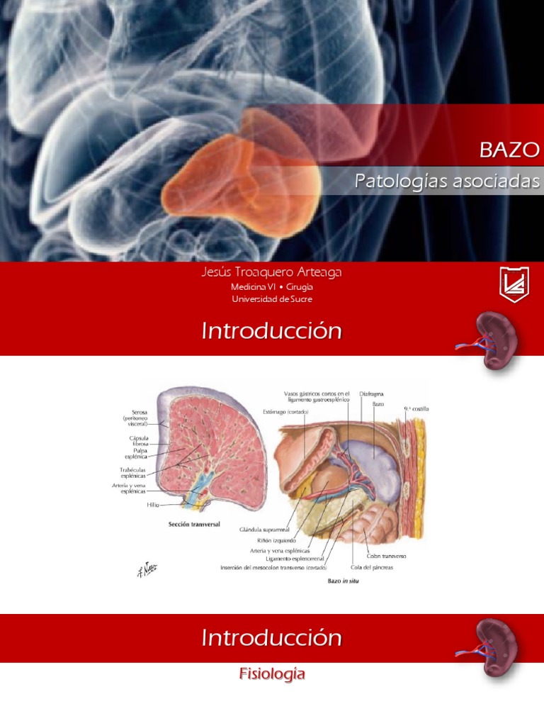 Patologías y Tratamientos del Bazo | PDF | Enfermedad de célula ...