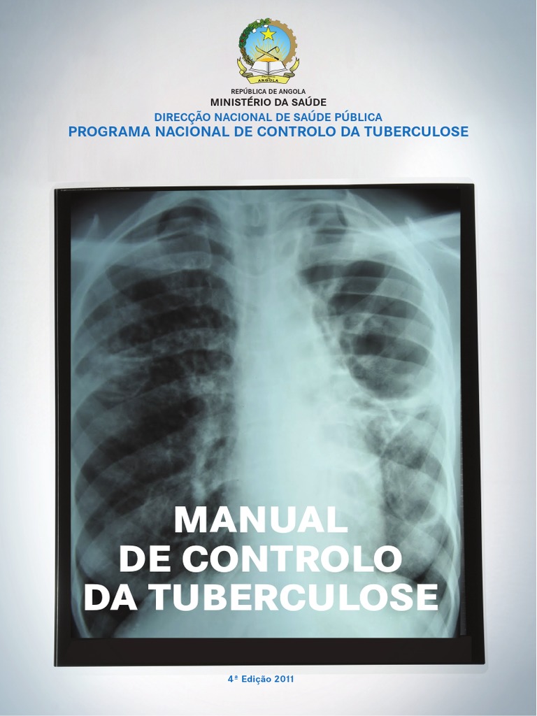Manual Controlo Da TB Angola | PDF | Tuberculose | Mycobacterium ...
