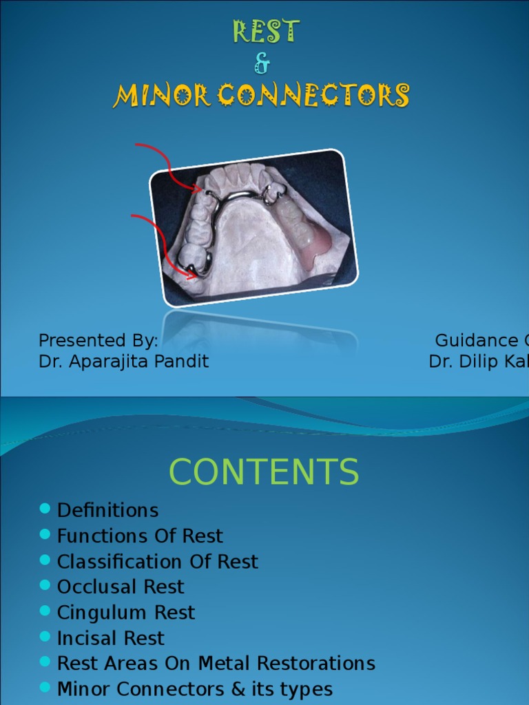 Rest N Minor Connector | PDF | Dentures | Dental Anatomy