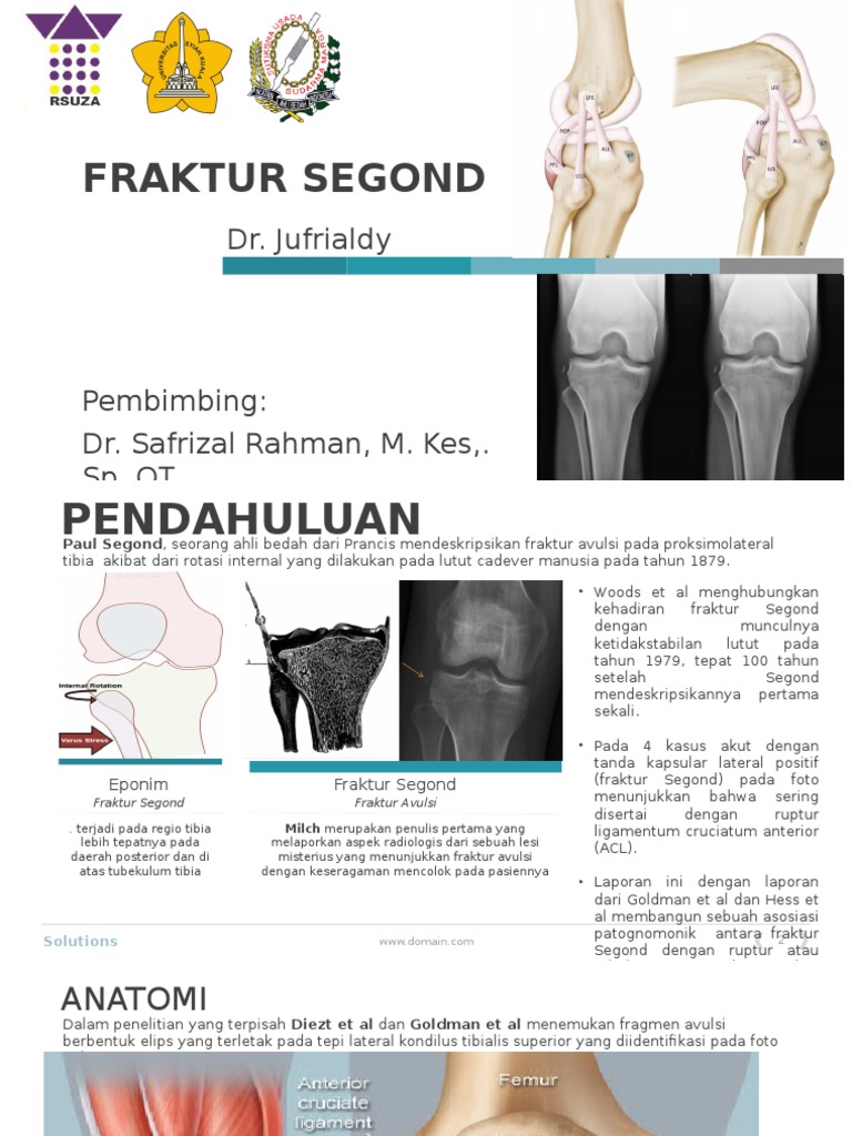 Fraktur Segond: Diagnosis dan Pengobatan | PDF