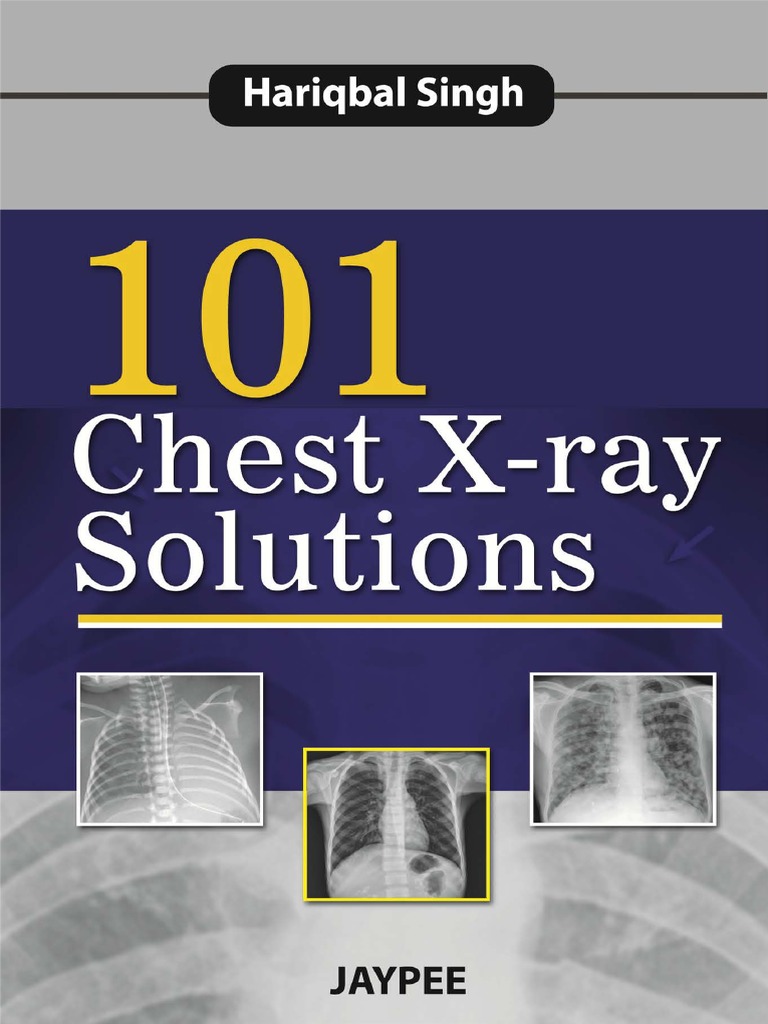 101 Chest X Ray Solutions 2013 | Download Free PDF | Thorax | Aorta
