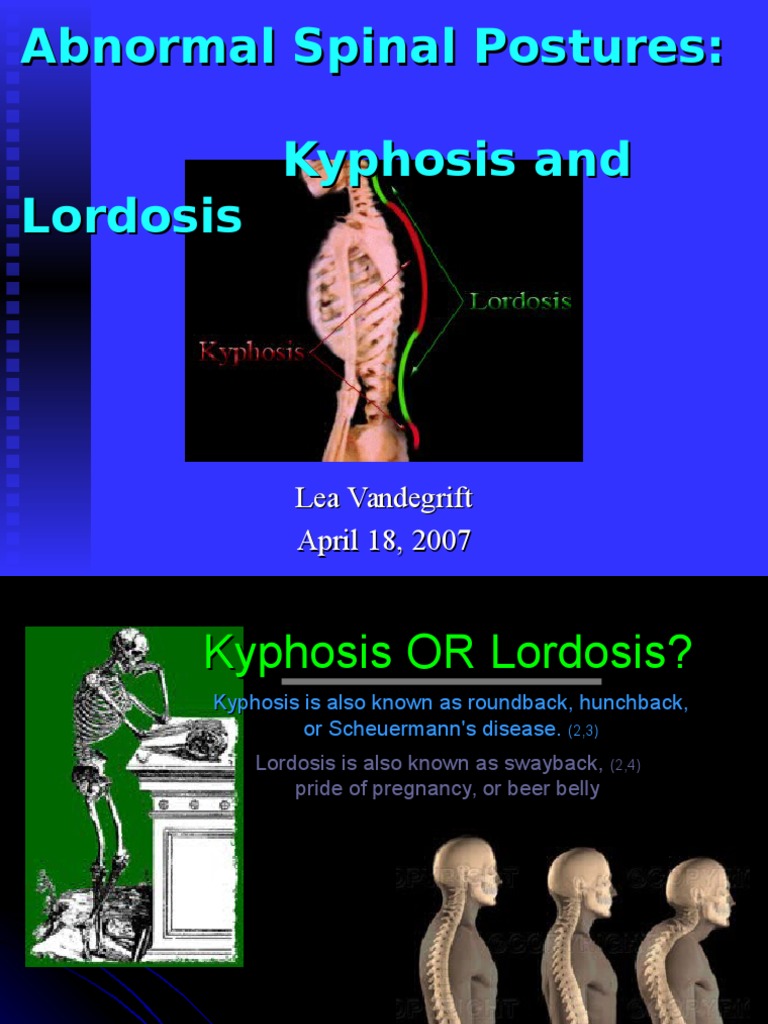 Abnormal Spinal Postures Kyphosis and Lordosis4352 | Clinical Medicine ...