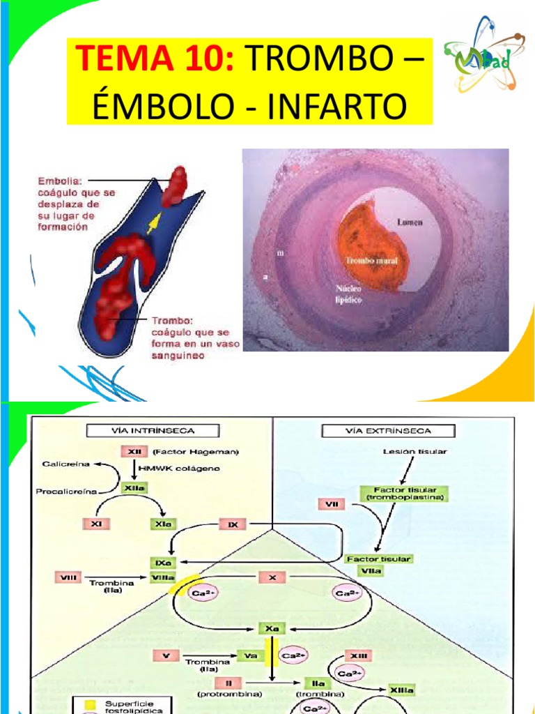 Clase 10 - Trombo - Embolo - Infarto | Embolia | Trombo