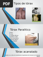 Tipos de Torax | PDF | Tórax | Sistema esquelético