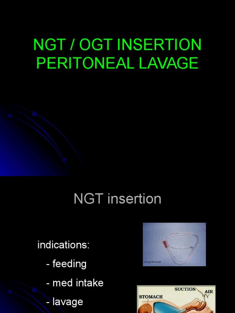 NGT Peritoneal Lavage | PDF | Medicine | Medical Specialties