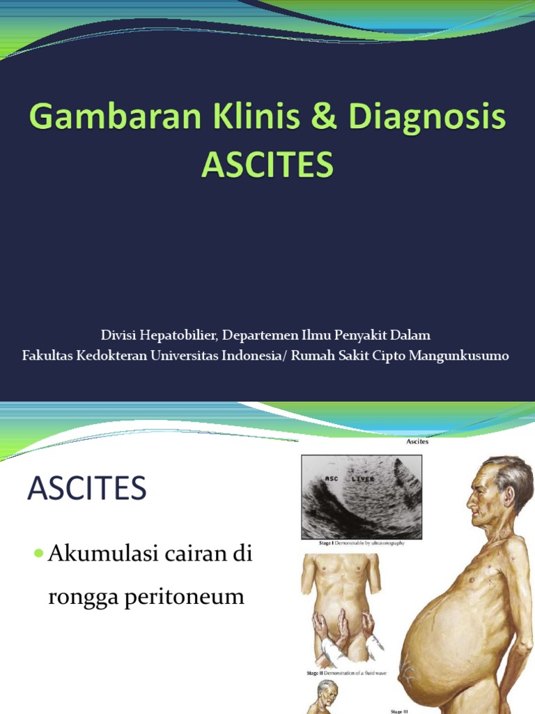 Analysis of Ascitic Fluid: A Guide to Diagnosing the Underlying Causes ...