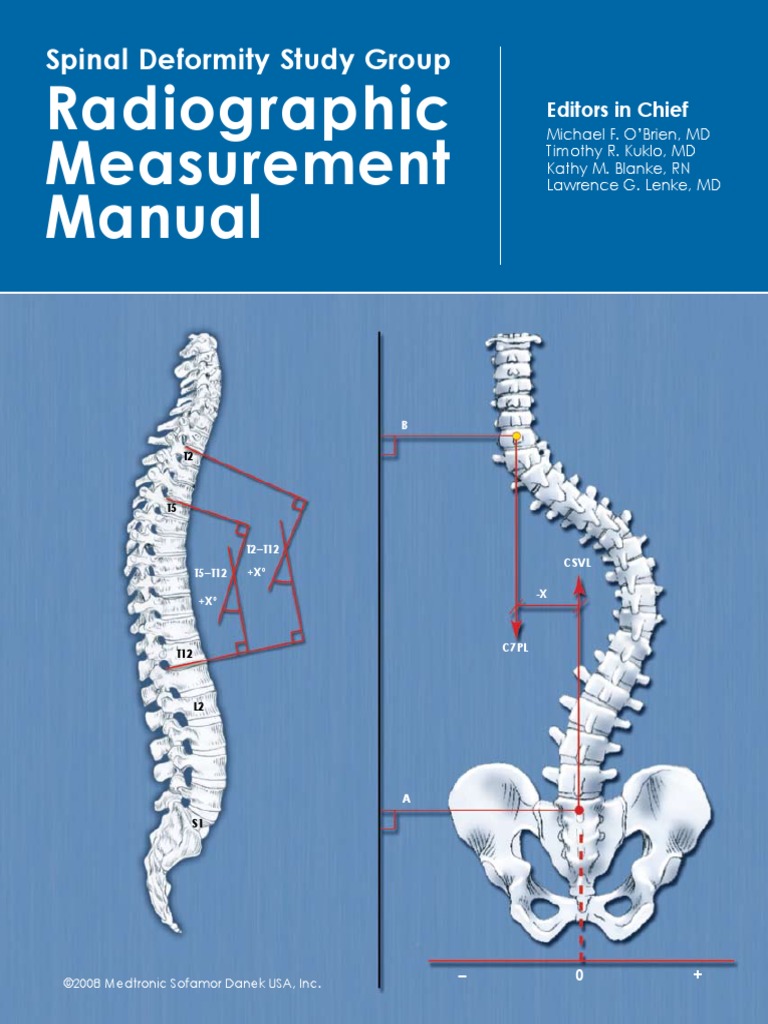SDSG Radiographic Measuremnt Manual | PDF | Vertebral Column | Vertebra