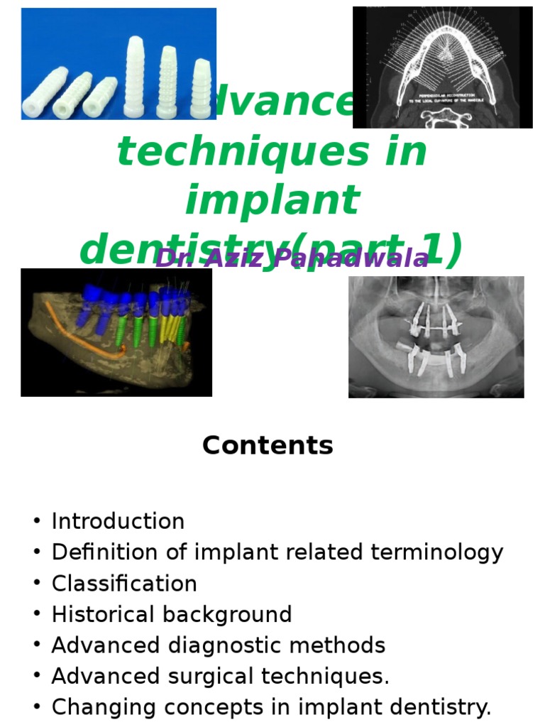 Implant | PDF | Dental Implant | Tomography