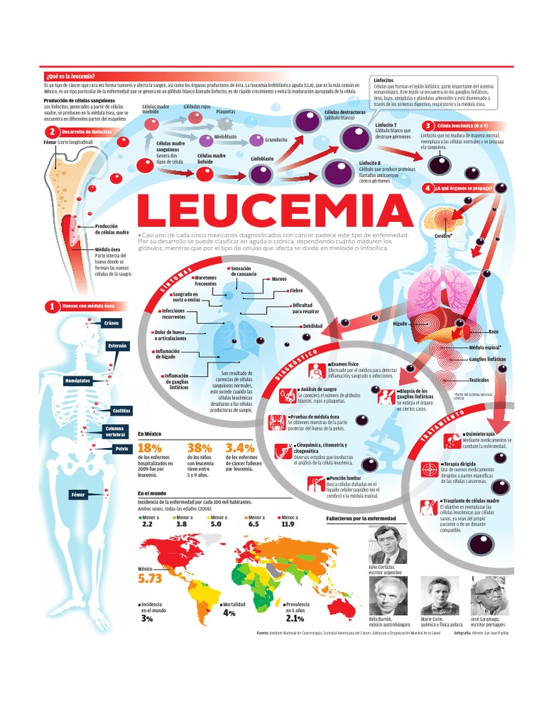 Leucemia PDF | PDF | Leucemia | Linfocitos