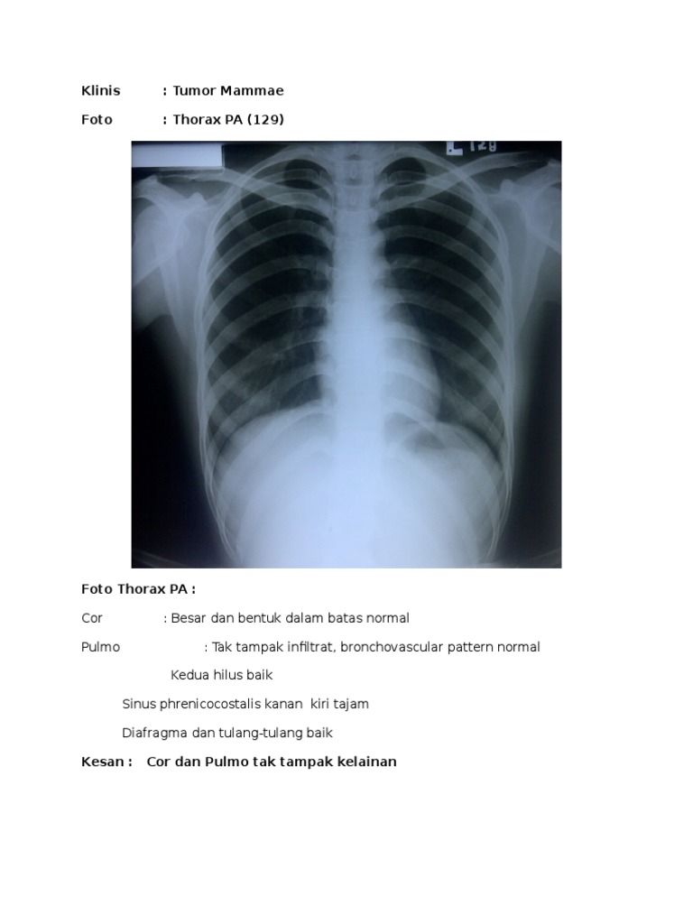 Contoh Bacaan Radiologi | PDF