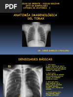 INTERPRETACION DE RX TORAX AP, PA Y LATERAL | PDF | Pulmón | Tórax ...