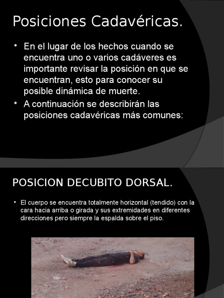 Posiciones Cadavéricas Comunes | PDF | Religión y espiritualidad