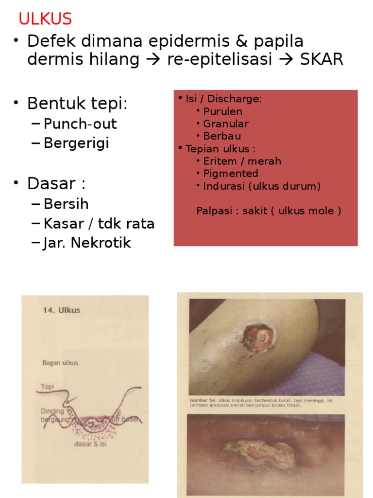 Ulkus Dan Sikatrik | PDF