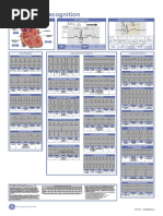 Ecg MCQS | PDF | Electrocardiography | Cardiology