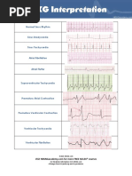 Basic EKG ECG Rhythms Cheatsheet | Electrocardiography | Cardiac ...