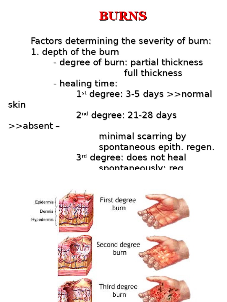 Burns | PDF | Burn | Kidney