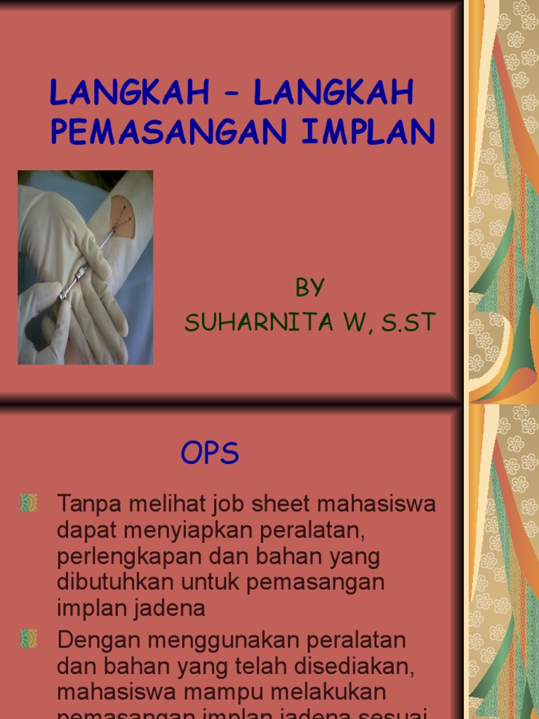 Langkah - Langkah Pemasangan Implan | PDF
