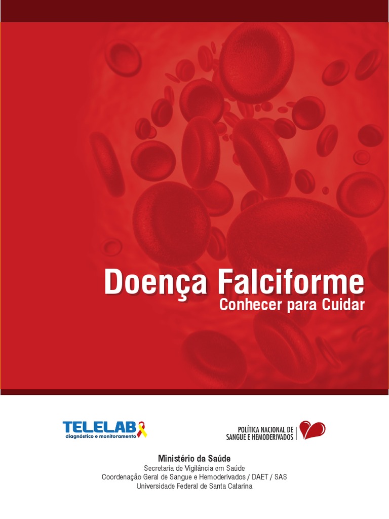 Doença Falciforme | Doença Falciforme | Anemia