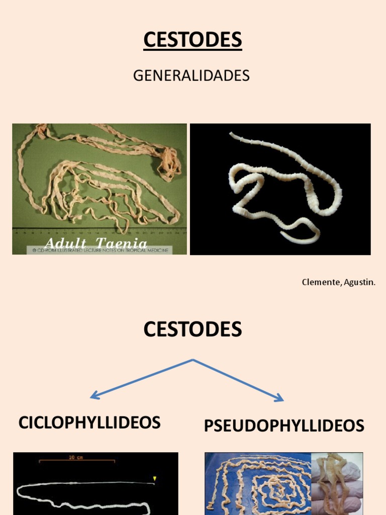 Cestodes