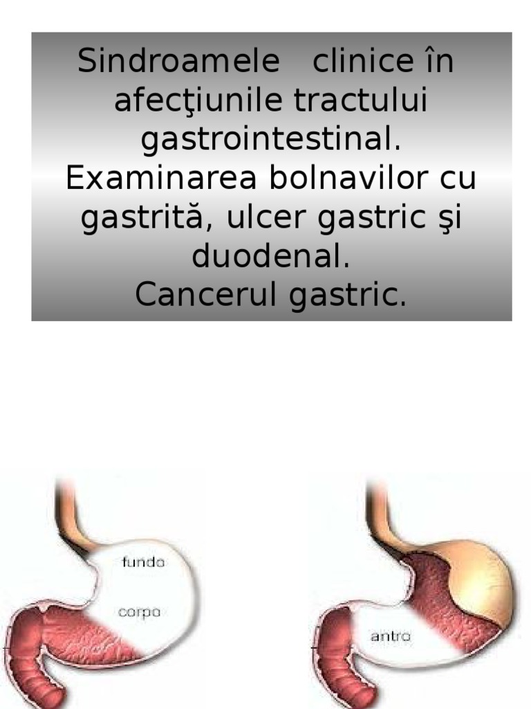 Gastrite | PDF