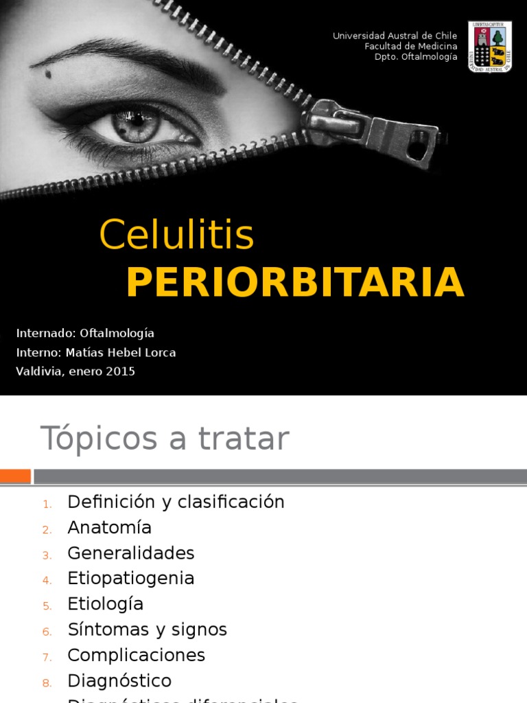 Celulitis Periorbitaria | PDF | Rtt | Inmunología