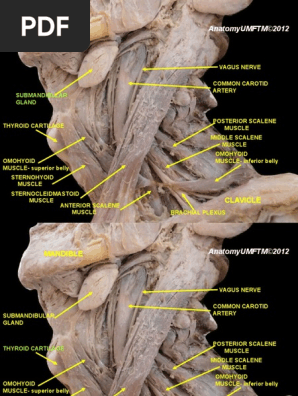 Sternohyoid Cadaver
