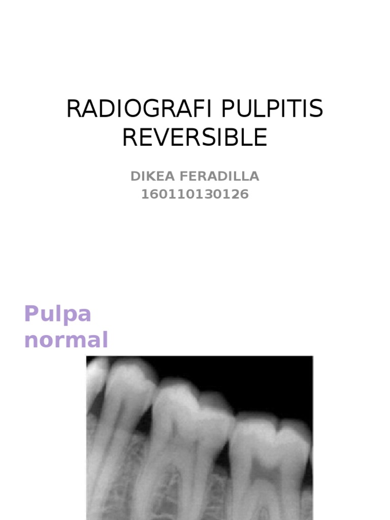 RADIOGRAFI PULPITIS REVERSIBEL