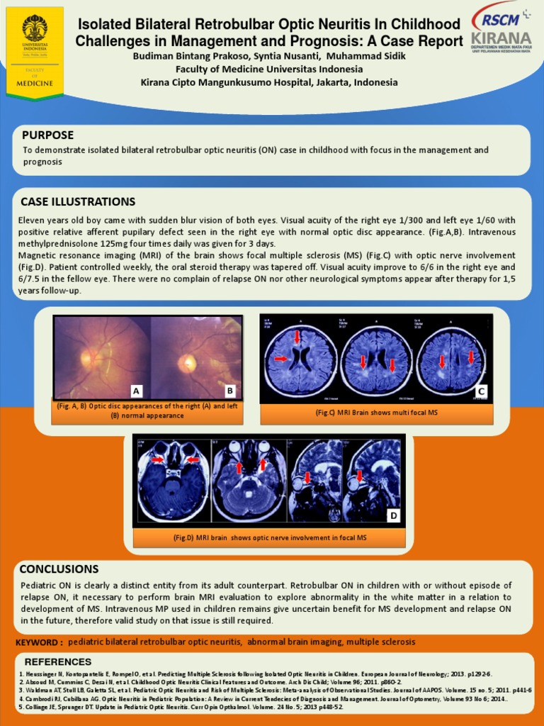 Retrobulbar ON Child | PDF | Science & Mathematics