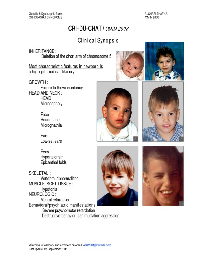 Cri Du Chatsyndrome | PDF