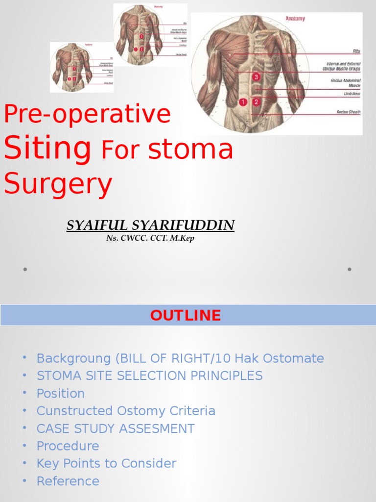7. Stoma Siting - Iful Syarif Al Munawi | Abdomen | Surgery