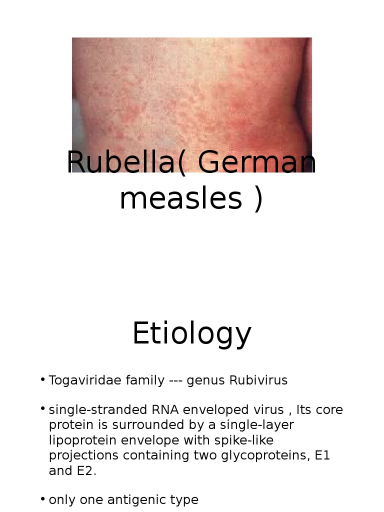 Rubella | PDF | Congenital Disorder | Antibody