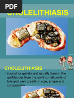 Pathophysiology of Choledocholithiasis | PDF