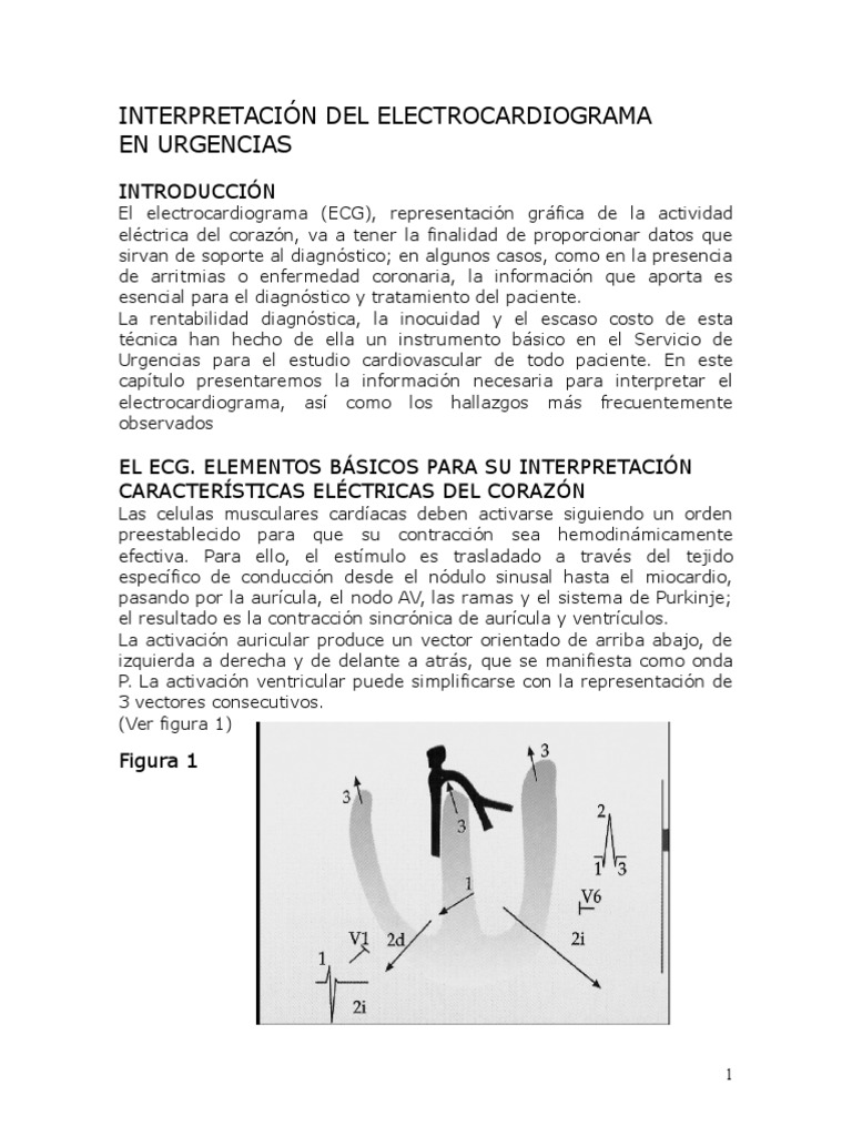 Interpretación Del Electrocardiograma | PDF | Electrocardiografia ...