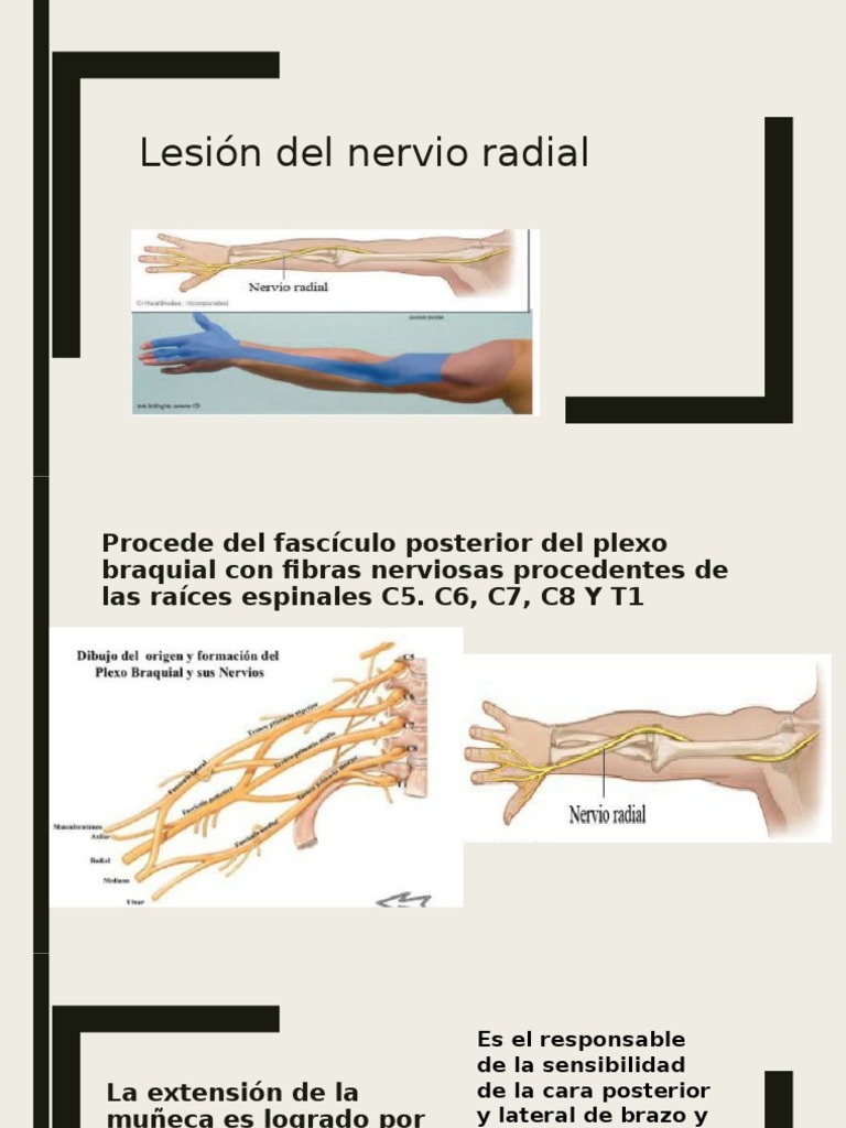 Nervio Radial | Descargar gratis PDF | Sistema musculoesquelético ...
