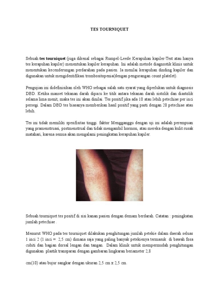 SOP Rumple Leed Test 2 | PDF