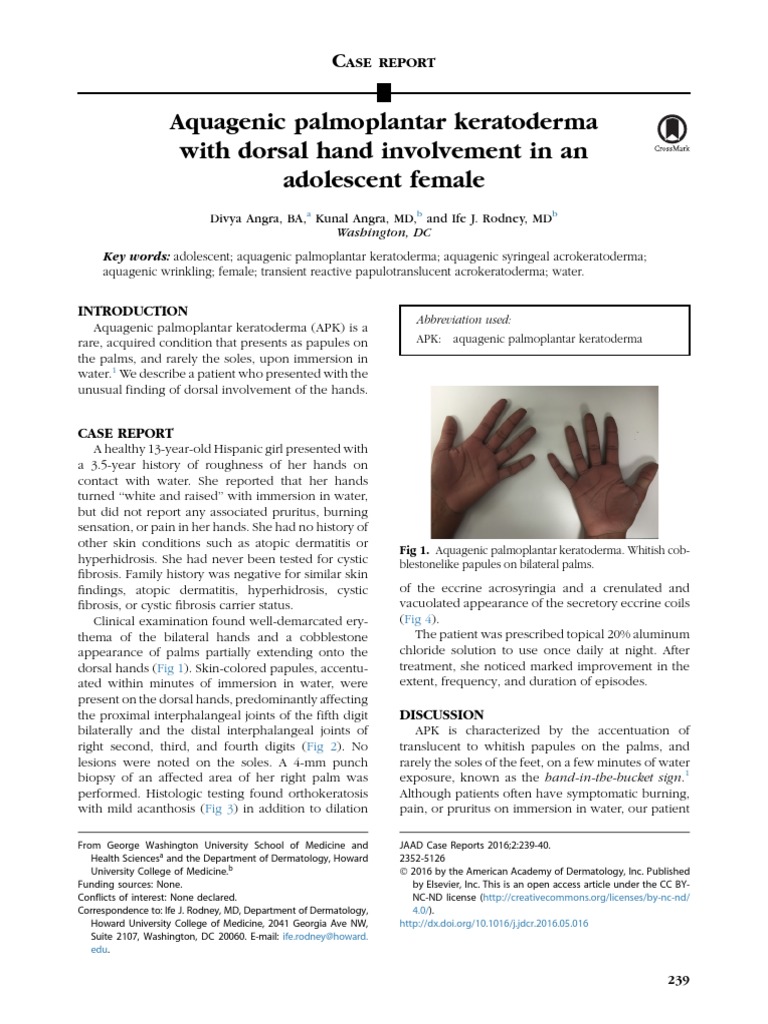 Aquagenic Palmoplantar Keratoderma With Dorsal Hand Involvement in An ...