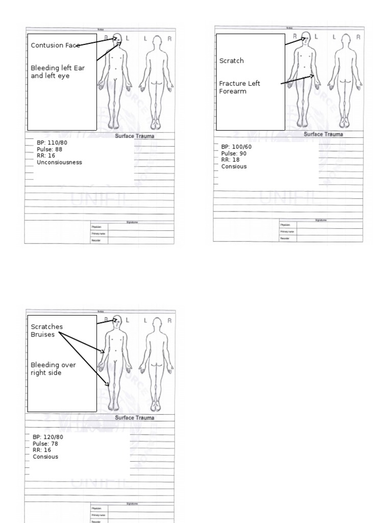 Contusion Face Scratch: BP: 110/80 Pulse: 88 RR: 16 Unconsiousness BP ...