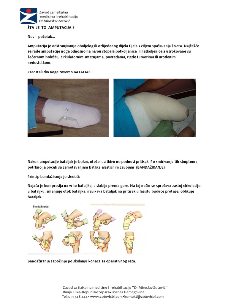 Uputstvo-za-pacijente-nakon-amputacije-ekstremiteta.pdf