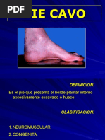 Pie Talo, Pie Varo, Valgo, y Pie Plano | PDF | Pie | Tobillo