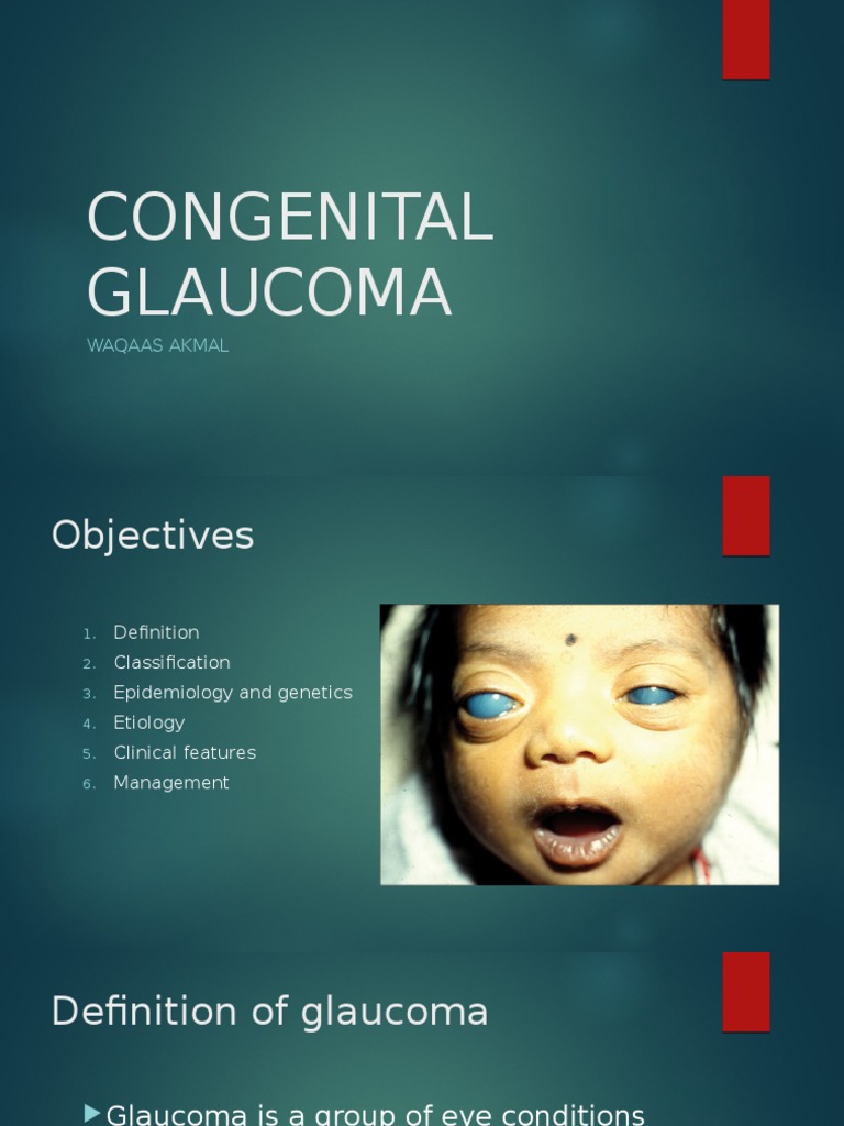 Congenital Glaucoma | PDF | Glaucoma | Congenital Disorder