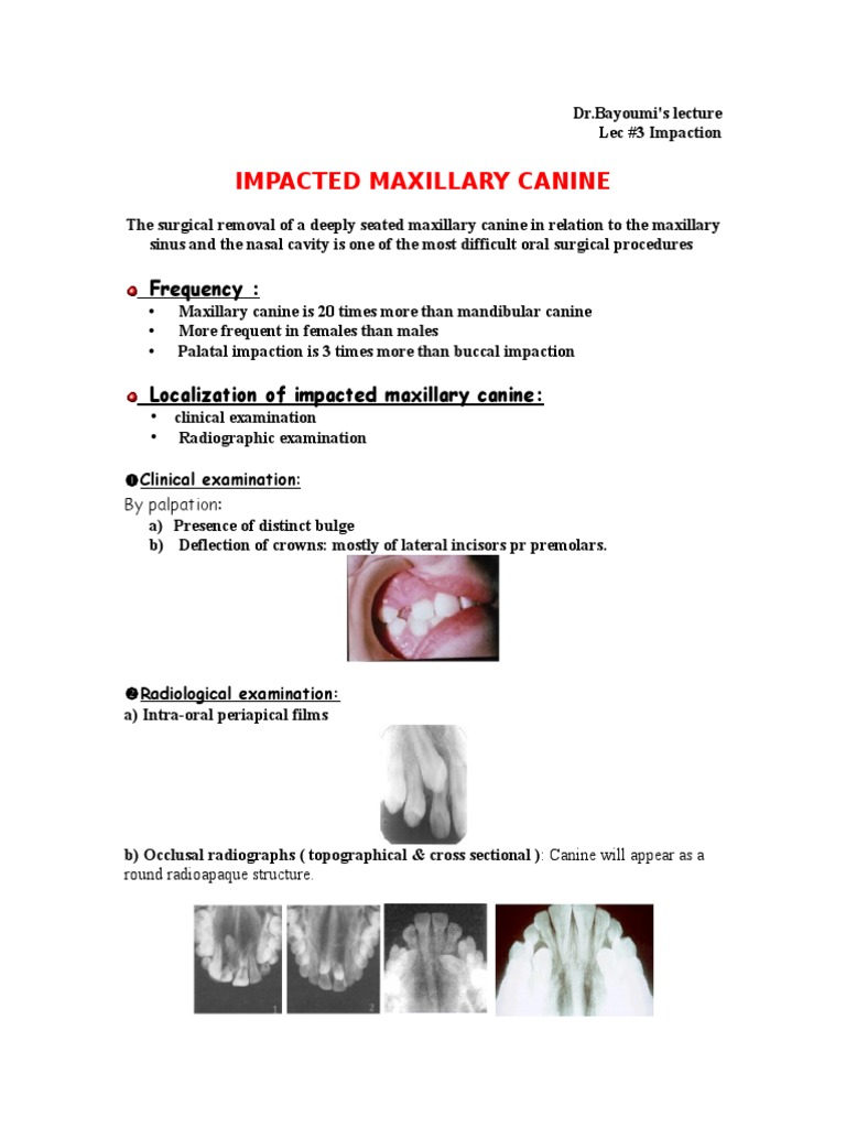 Impacted Maxillary Canine Surgical Exposure | Dental Anatomy | Medical ...