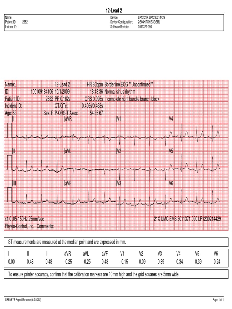 Name: Patient ID: Incident ID: 2582 Device: Device Configuration ...